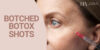 Is Botox Safe for Seniors? What to Know About Botox After 65 - House of ...